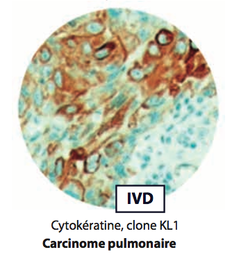 Cytokératine KL1 de nouveau disponible!